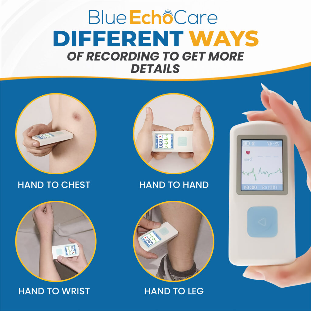 BeC Portable ECG Monitor – Blue Echo